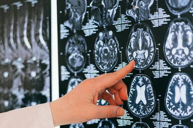 Qué es el dolor neuropático y cuáles son sus síntomas