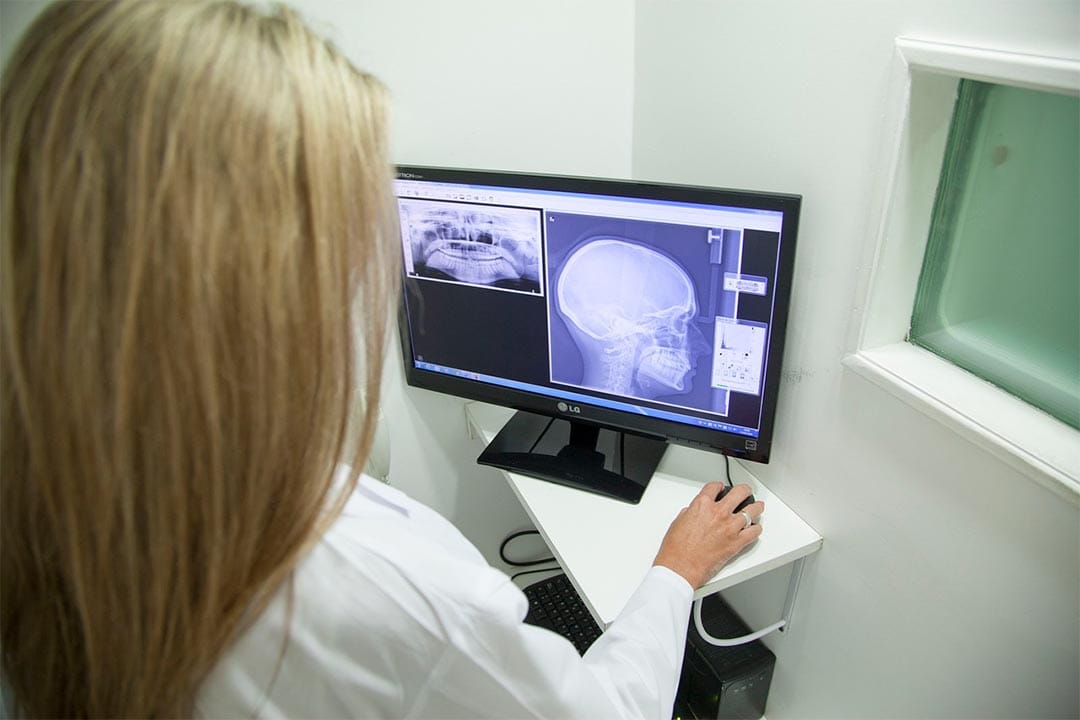 Traumatismo craneoencefálico: tipos y sus síntomas