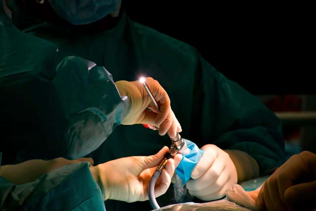 Microdiscectomía en hernia discal lumbar | Qué debes saber